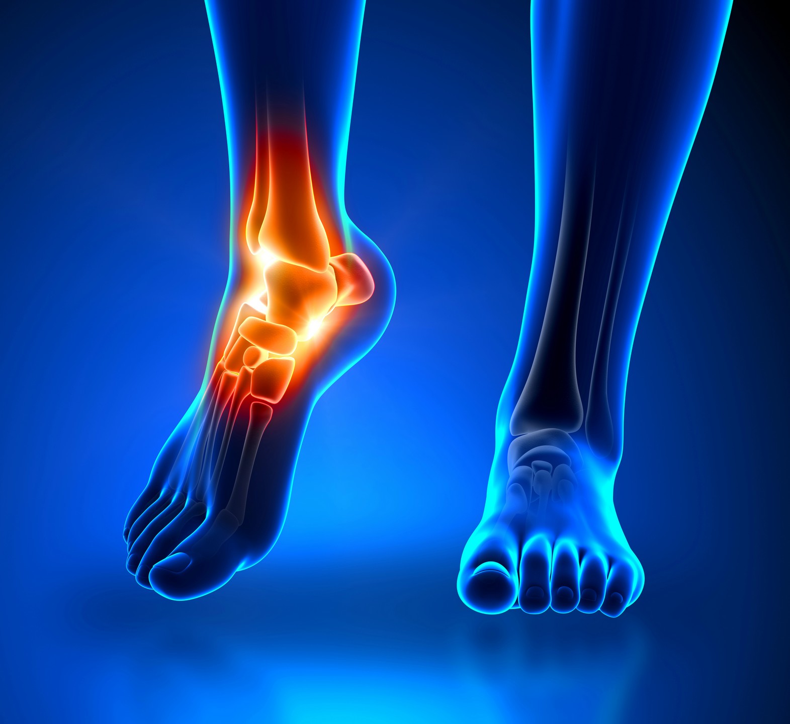 Gebroken Enkel - Fysiotherapie VitiFysio Venlo | Vitisha Thakoersingh ...