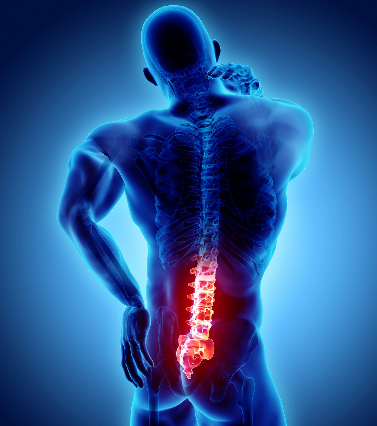 Rugklachten - Fysiotherapie VitiFysio Venlo | Vitisha Thakoersingh ...